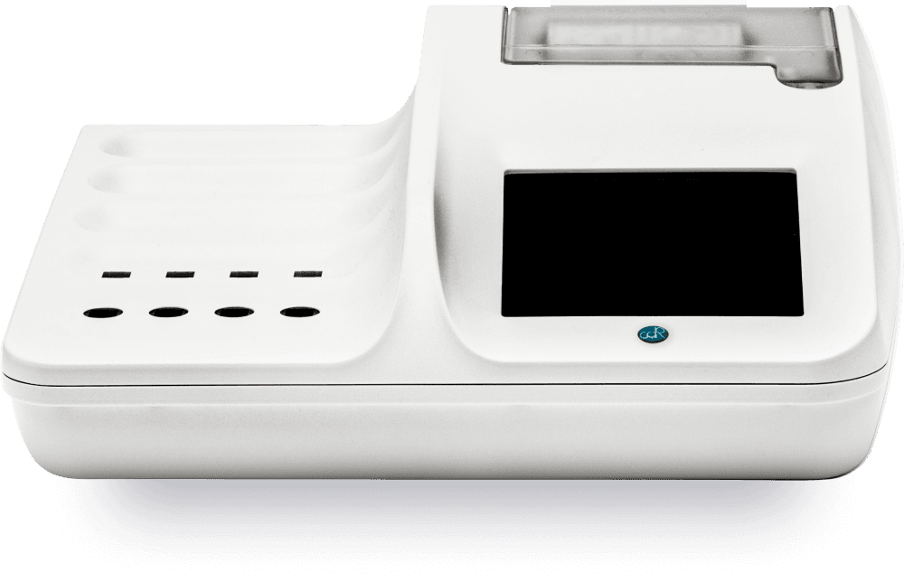 Milk analysis: Milk Urea Nitrogen (MUN) test